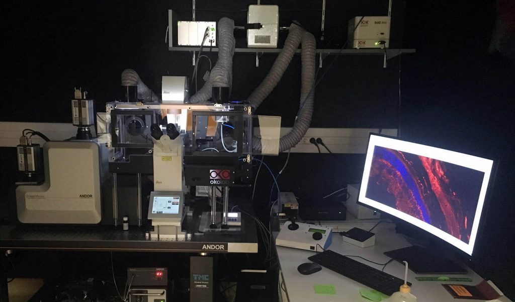 Dragonfly - High Speed Confocal Microscopy | ImagXcell