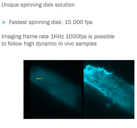 X-LightV2-spinning-disk-confocal | ImagXcell